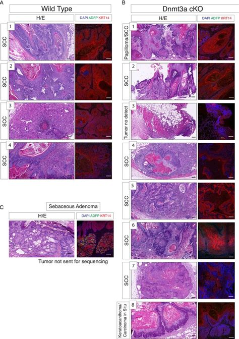 Figures And Data In Loss Of Dnmt A And Dnmt B Does Not Affect Epidermal Homeostasis But Promotes