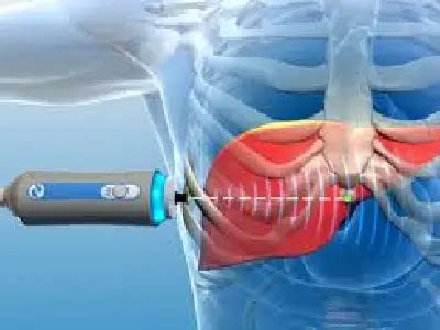 Fibroscan Dr Amol Shinde