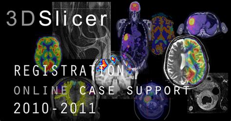 Slicer3 Registration Slicer Wiki