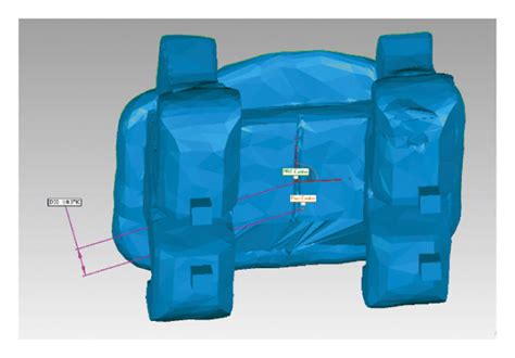 Measurement Of The Linear Deviation Between The Preoperative And