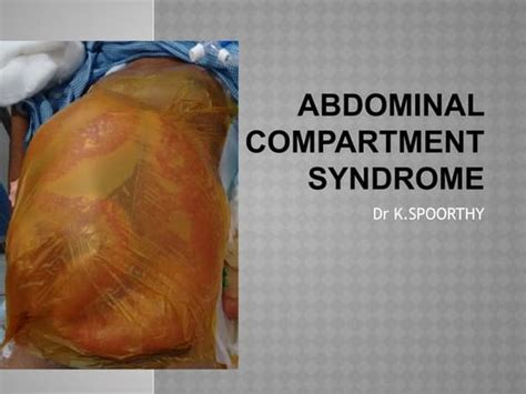 Abdominal Compartment Syndrome Powerpoint Slides Ppt