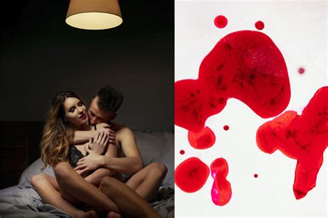 सकस क दरन कय आत ह खन जन करण और इलज