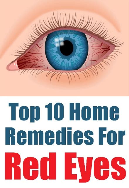 Top 10 Home Remedies For Red Eyes Home Remedies