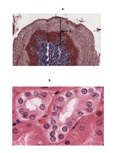 Solved Based On The Naming System Of Epithelial Tissues That