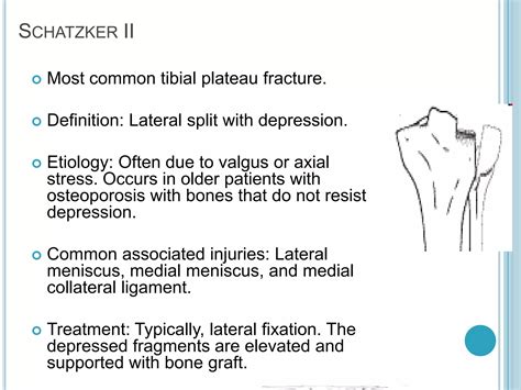 Proximal Tibia Fracture Ppt