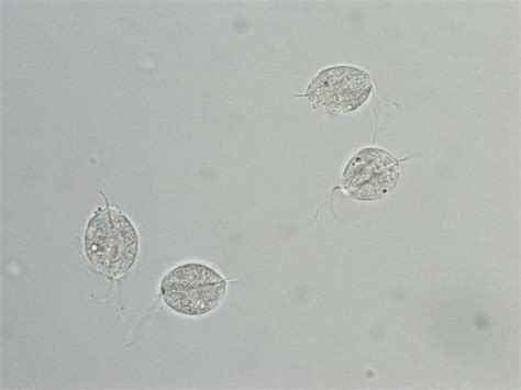 Trichomonas Vaginalis Wet Mount