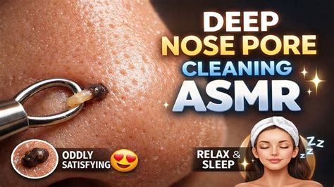 Deep Nose Pore Cleaning Asmr 😌 Ultra Satisfying Blackhead Removal No