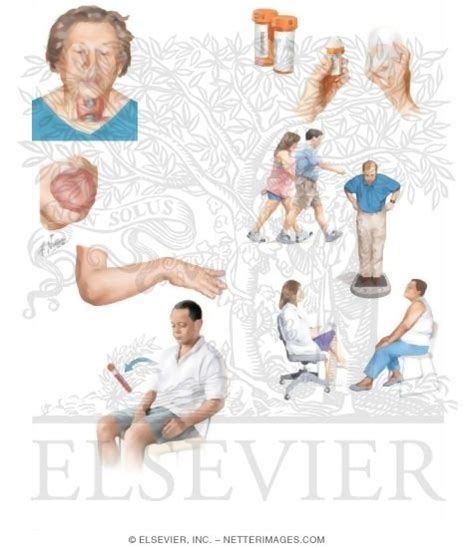 Managing Your Hypothyroidism