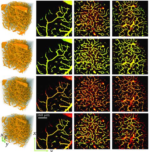 Deterioration Of Two Photon Microscopy Signal With Imaging Depth A Download Scientific