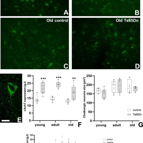 Senescence Of Cholinergic Neurons In The Ts65dn Mouse Model Download Scientific Diagram