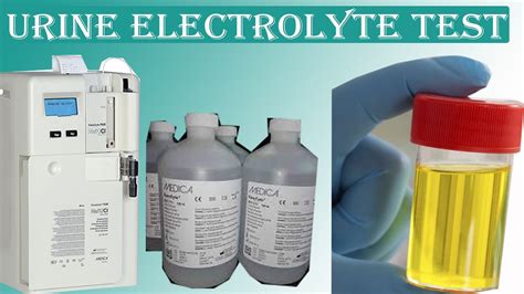 Lab Values For Electrolytes At Tyler Aikenhead Blog