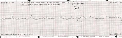 ECGs EMS Babe Page