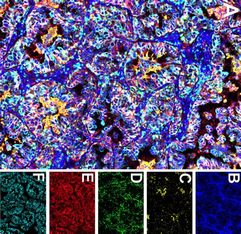 Multiplex Ihc Analysis Made Easy
