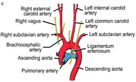 Aortic Arch Branches