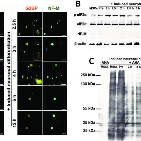 Sgs Are Associated With Neuronal Differentiation Of Stem Cells A Download Scientific Diagram