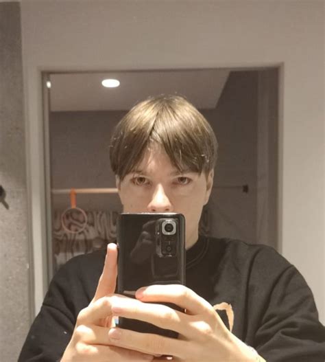 I Had A Very Intense Extropia And Got Surgery Today On Both Eyes I Am