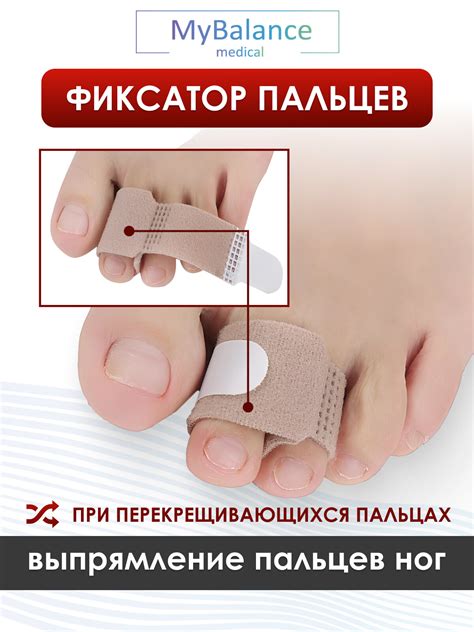 Фиксатор для поломанного пальца ноги вместо гипса — купить по низкой цене на Яндекс Маркете