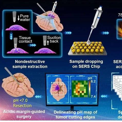 学术动态｜复旦大学毛颖 李聪等团队搭建代谢边界脑胶质瘤手术导航系统 发表在advanced Science 拉曼 技术 组织