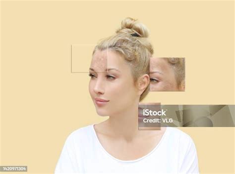 다크 스팟 주근깨 과색소 침착 개념 피부 미백 피부 미백 과일 산 Aha 피부 브라이트닝 50 54세에 대한 스톡 사진 및 기타 이미지 Istock