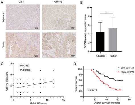 A The Ihc Assay Of Gal 1 And Grp78 Expression In Gc Tissues And Download Scientific Diagram