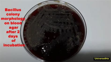 Bacillus Species Introduction Classification And Medically Important Spec