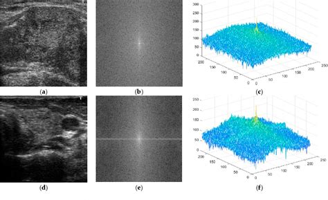 Figure 2 From Artificial Intelligence Based Thyroid Nodule