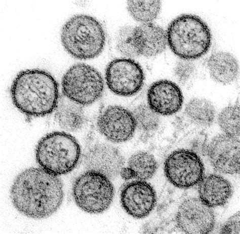 Imagen Gratis Micrográfica El Estudio El Hígado El Tejido El