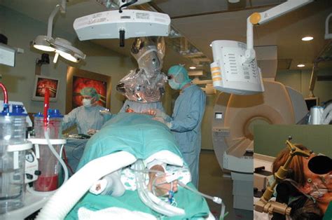 Brain Shift And Updated Intraoperative Navigation With Intraoperative Mri Radiology Key