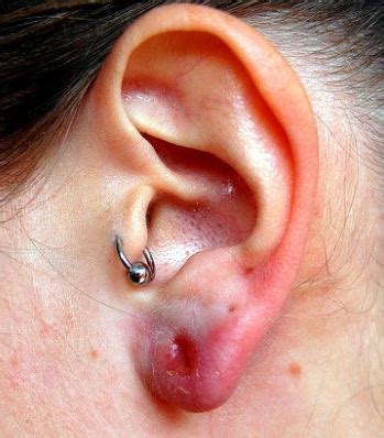 How Do Piercings Get Infected Swollen Ear Why Do Piercings Get Infected