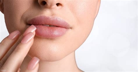 ‘pillow Face The Perils Of Too Much Filler Dermatology Associates