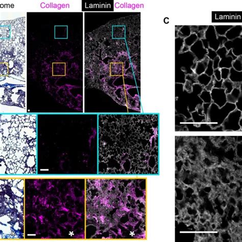Basement Membrane Remodeling Phenotype In Bleomycin Lung Injury A