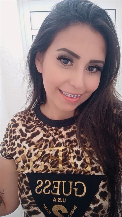 Hows Your Day Going Guys😊 Ramaturebraces