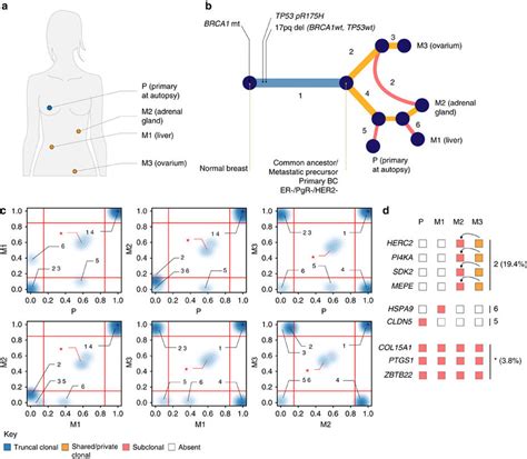 Nature子刊：全基因组测序技术报告原发肿瘤及其不同转移程度的遗传异质性 生物通
