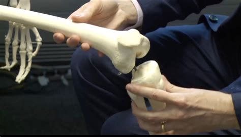 Musculoskeletal Embolization Cvir Endovascular Cirses Open Access Journal