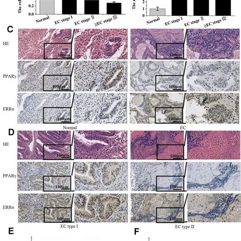 logistic regression model risk factors for endometrial cancer