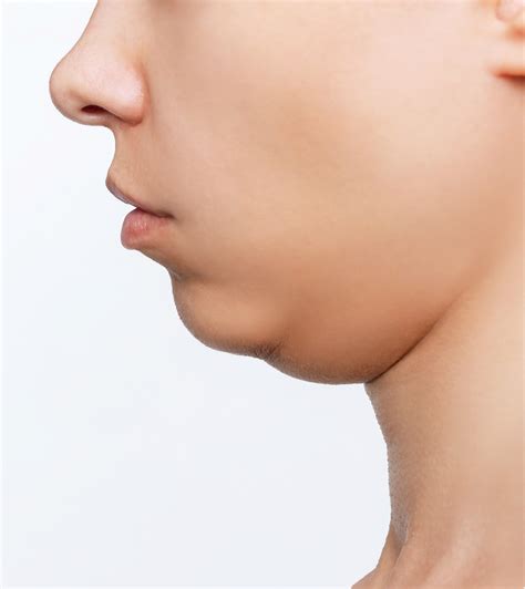 Profhilo Treatment Cost Benefits Procedure And Results