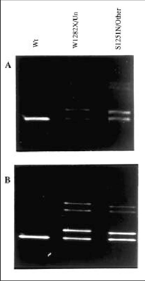 Comparison Between DGGE A And DG DGGE B For Analysis Of Point Download Scientific Diagram