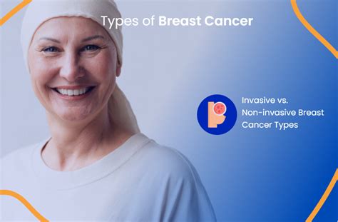 Breast Cancer Treatment In Florida Types Symptoms And Diagnosis