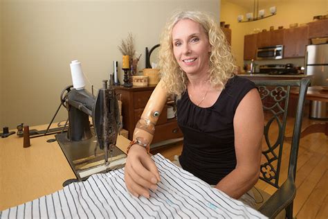 Introduction To Activity Specific Prostheses