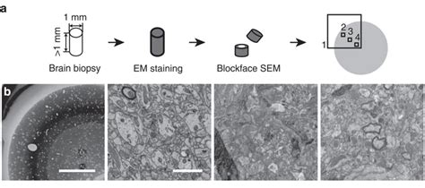 Via Webinar Saturated Osmium En Bloc Staining Of Whole Organs For High