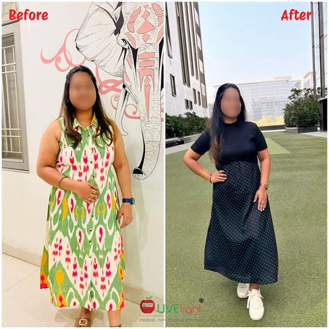 Weight Loss Injections Non Surgical Fat Reduction In Thane At Livelight