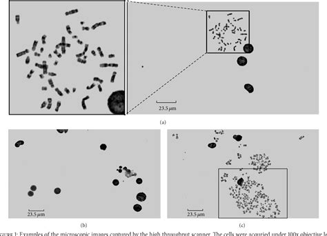 Figure 1 From Feature Selection For The Automated Detection Of Metaphase Chromosomes