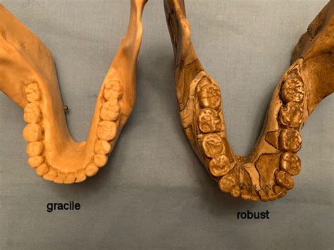 Solved Compare The Gracile And Robust Australopithecines
