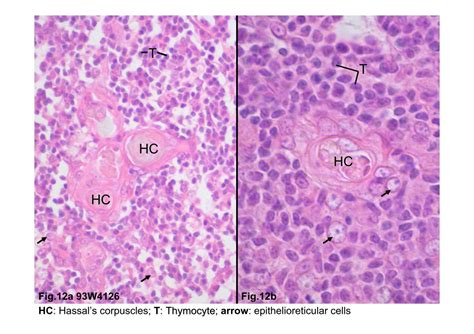 Block2fig12a Photomicrograph Of Thymus Medulla