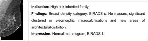 One Simple Example Of Mammography Report Download Scientific Diagram