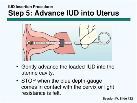 Ppt Tcu 380a Powerpoint Presentation Id3425298