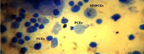 Photomicrograph Showing Polychromatic Erythrocytes PCEs Download Scientific Diagram