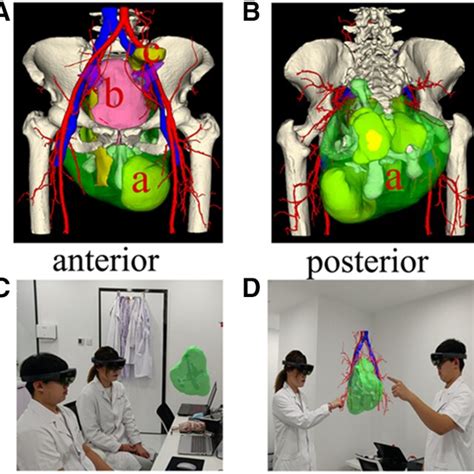The Application Of 3d Reconstruction And Mixed Reality Mr Technology Download Scientific