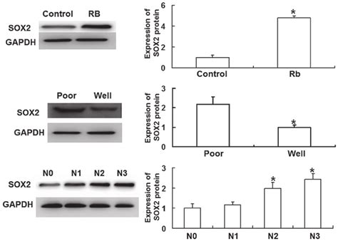 Sex Determining Region Y Box 2 Sox2 Protein Expression In