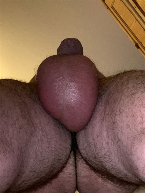 Glucose Percent Ml Pics XHamster